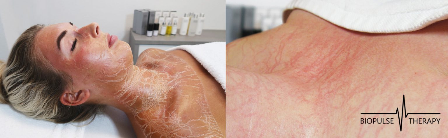 BioPulse Therapy - Beauty by Liss